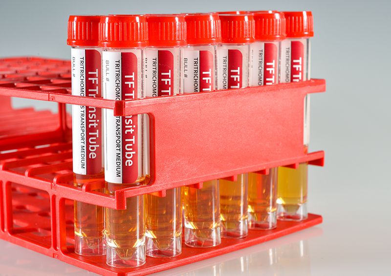 TF-Transit Tube [10 pk] | Biomed Webstore