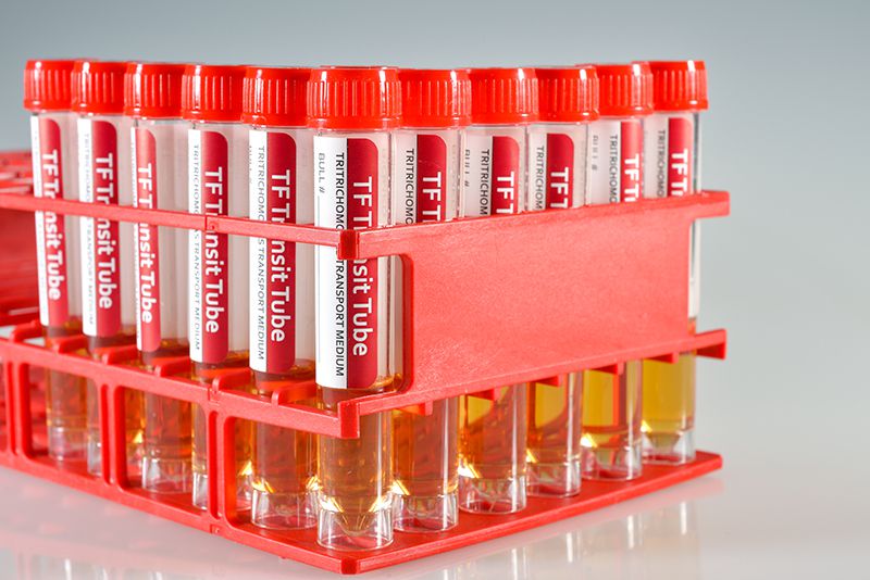 TF-Transit Tube [50 pk] | Biomed Webstore